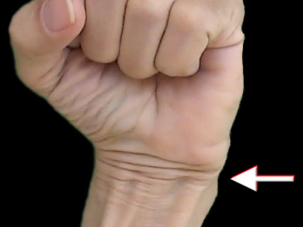 Cutaneous fold theory, evolution and pathology